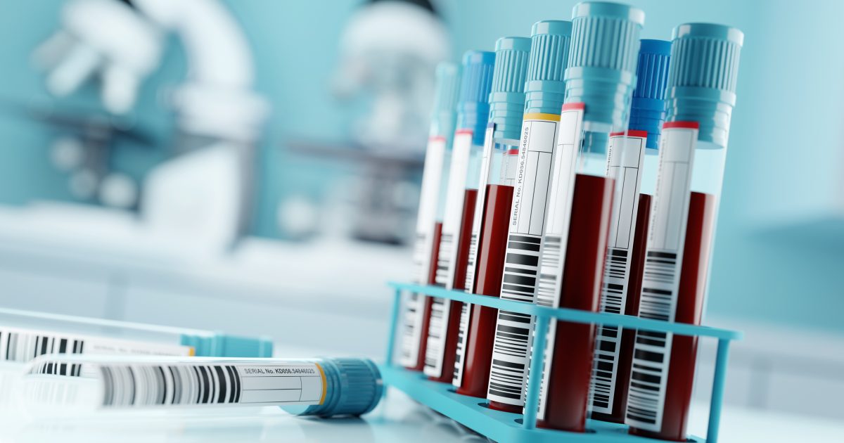 Inflammatory markers explained - ARC West